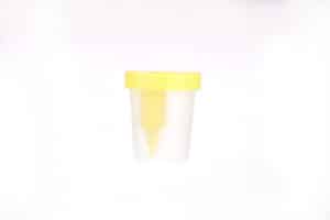 Psilocybin Drug Test- What Shows Up on Mushroom Drug Test?